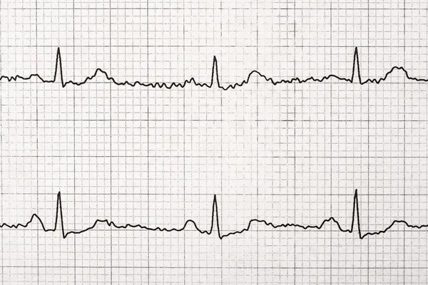 Normal heart rate Stock Photos, Royalty Free Normal heart rate Images ...