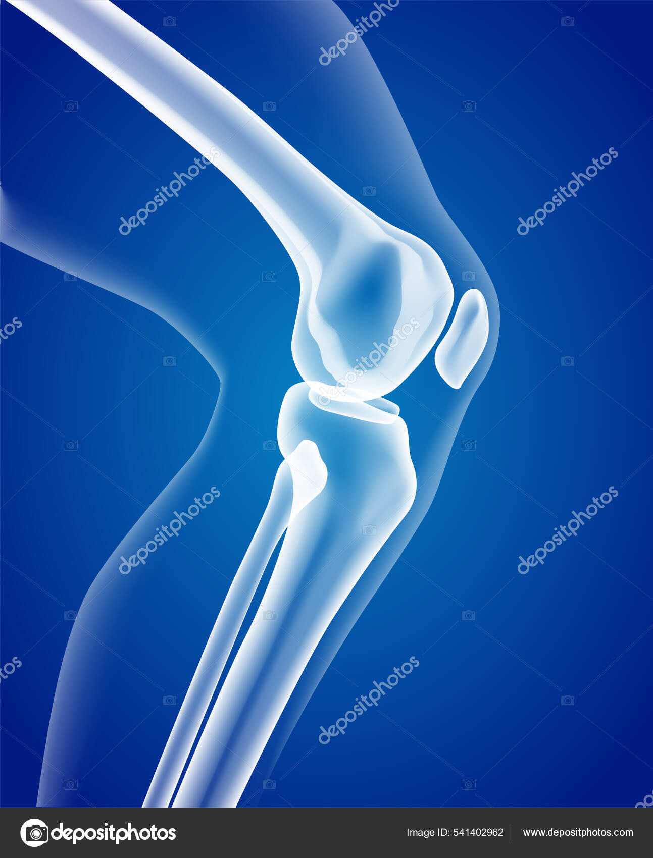 Educational Medical Illustration Leg Bones Stock Vector by ©peakanucha ...