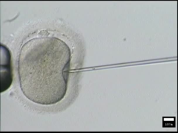 Injecting sperm into a woman's eggs to IVF — Stock Video © thanavut ...