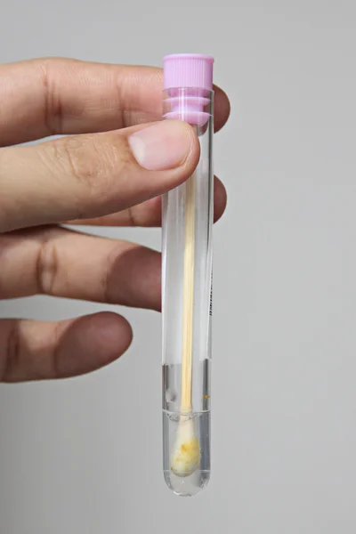 Blood in stool Stock Photos, Royalty Free Blood in stool Images ...