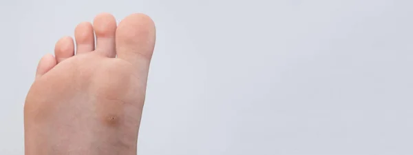 Foot thumb Stock Photos, Royalty Free Foot thumb Images | Depositphotos