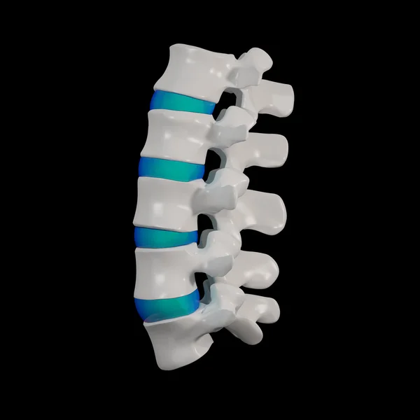 Mri lumbar spine Stock Photos, Royalty Free Mri lumbar spine Images ...