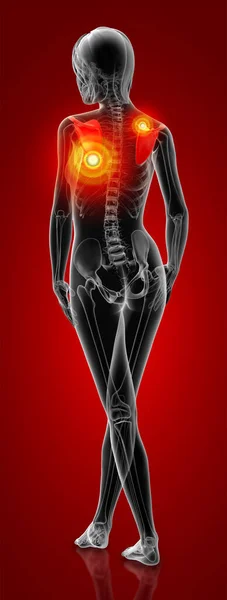 3d render female scapula bone - back view - Stock Image - Everypixel