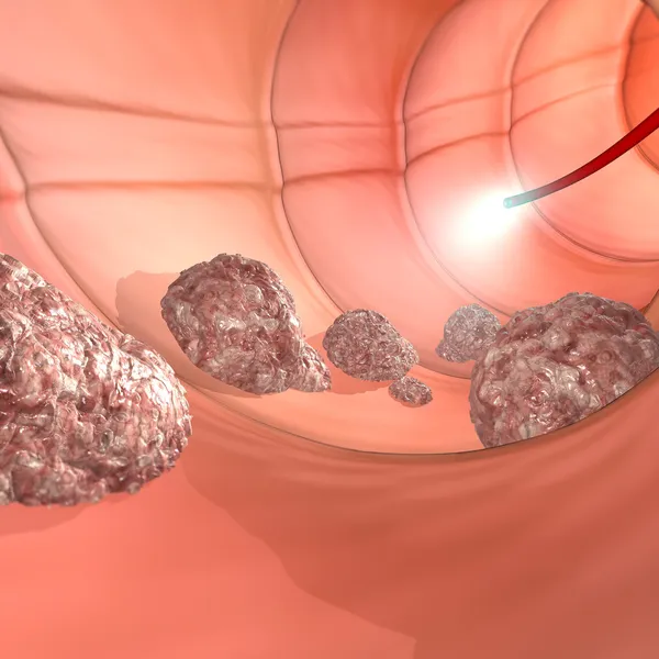 Blood stool Stock Photos, Royalty Free Blood stool Images | Depositphotos