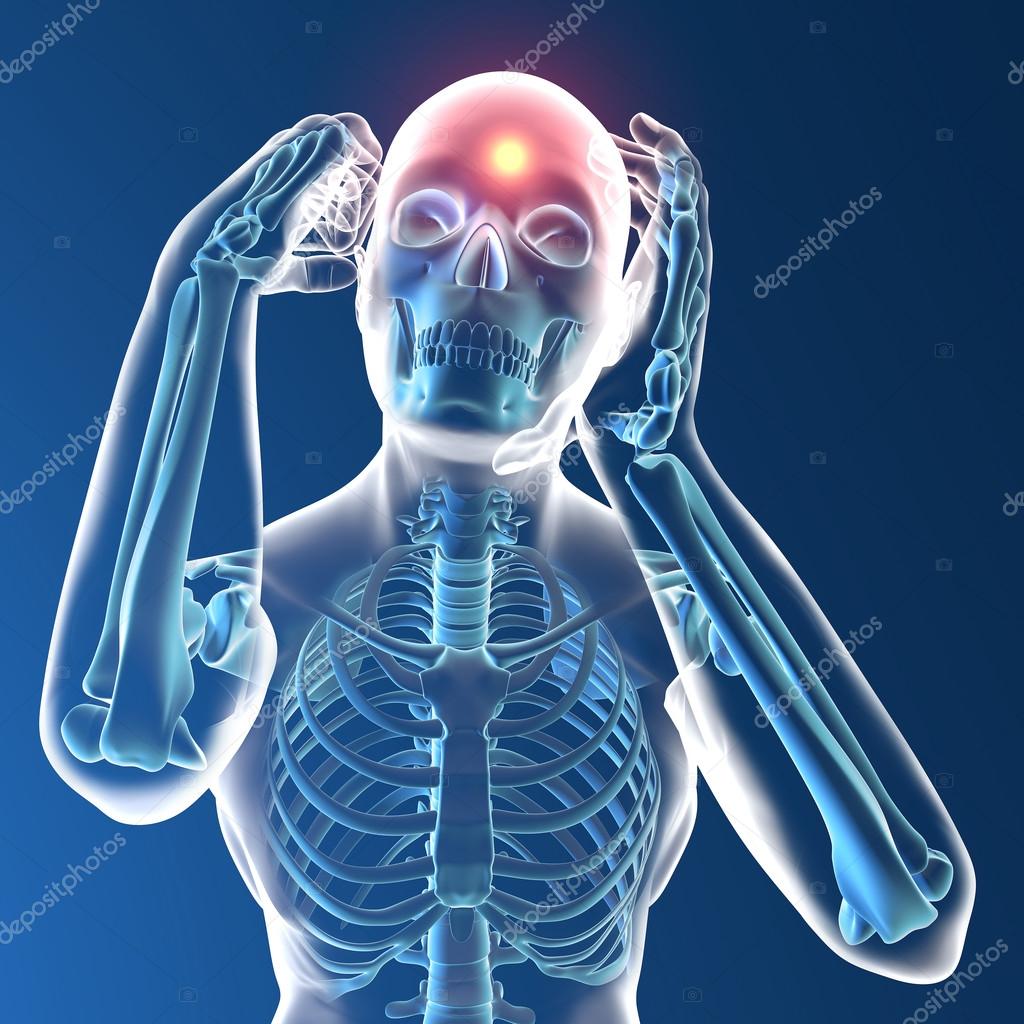 X-ray human with headache Stock Photo by ©vampy1 48622261