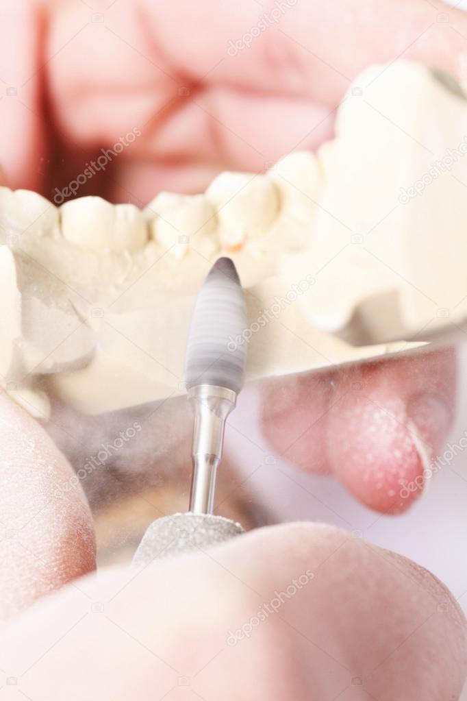 Dentist molding prosthetic teeth Stock Photo by ©racorn 26229077