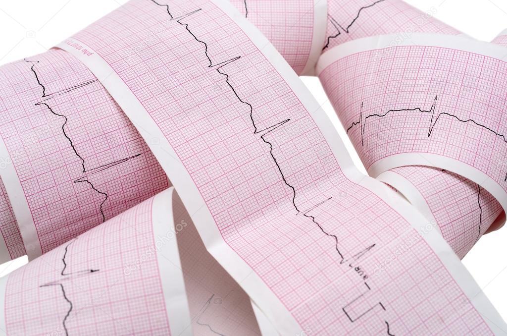 Gráfico de ECG de papel con pulso cardíaco 2024