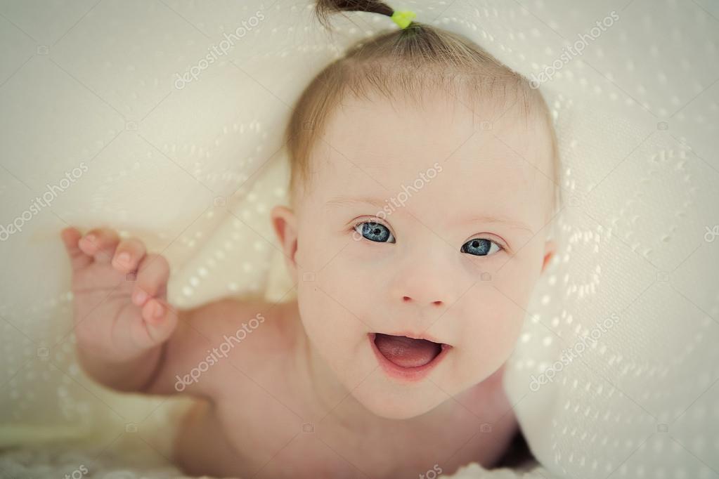 Down Syndrome Baby Girl Newborn