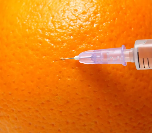 ᐈ Cellulitis stock photos, Royalty Free cellulitis on legs images ...