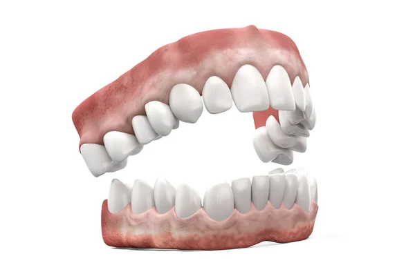 Teeth and gums open — Stock Photo © ChepeNicoli #6228134