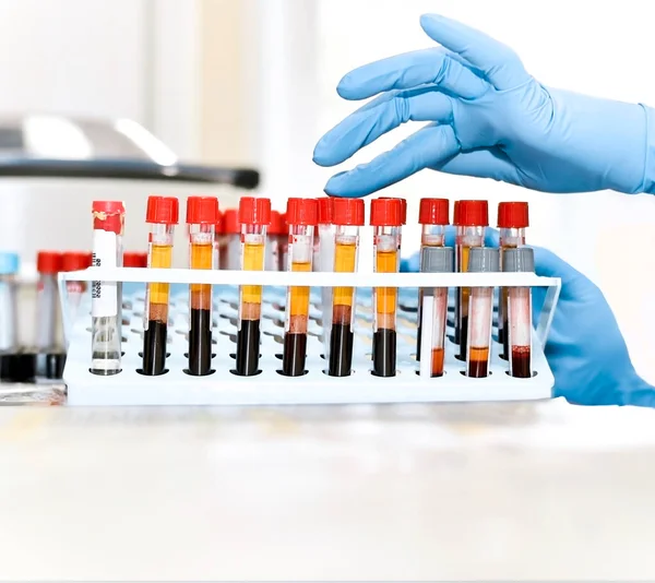 Esr Stock Photos, Royalty Free Esr Images | Depositphotos