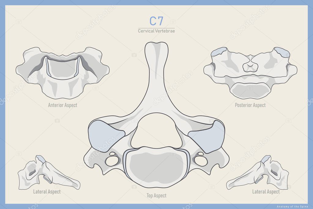 Anatomía de la séptima vértebra cervical. Vertebra Prominens C7. Vista ...