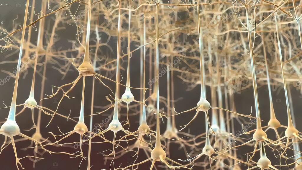 3d medical illustration Placas amiloides. La proteína beta-amiloide ...