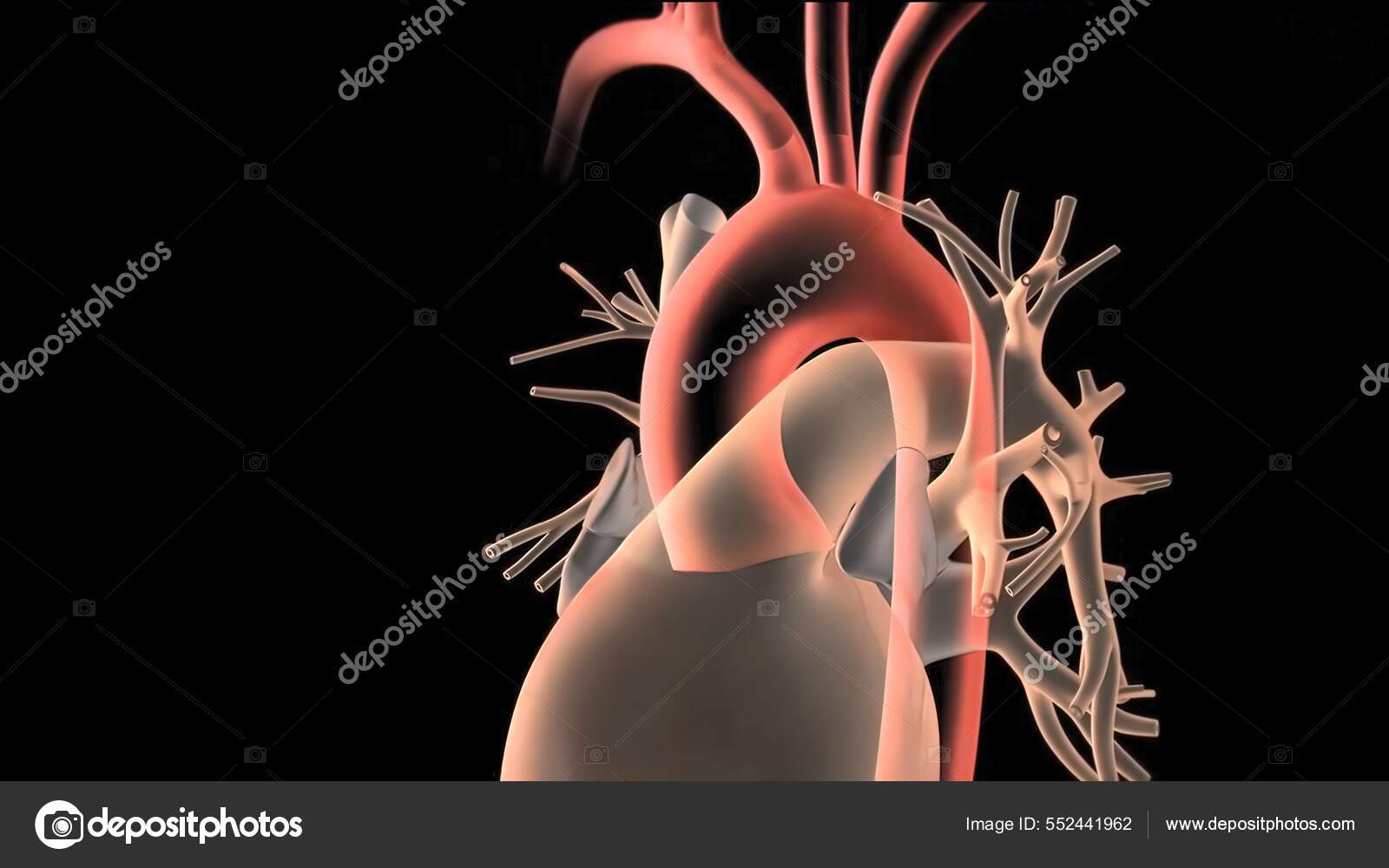 Síndrome Hipoplásico Del Corazón Izquierdo Defecto Cardíaco Congénito ...