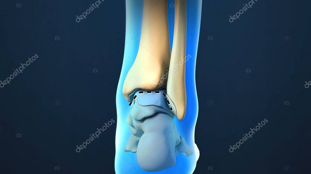 3D Renderizado de la articulación del tobillo Anatomía y osteoartritis ...