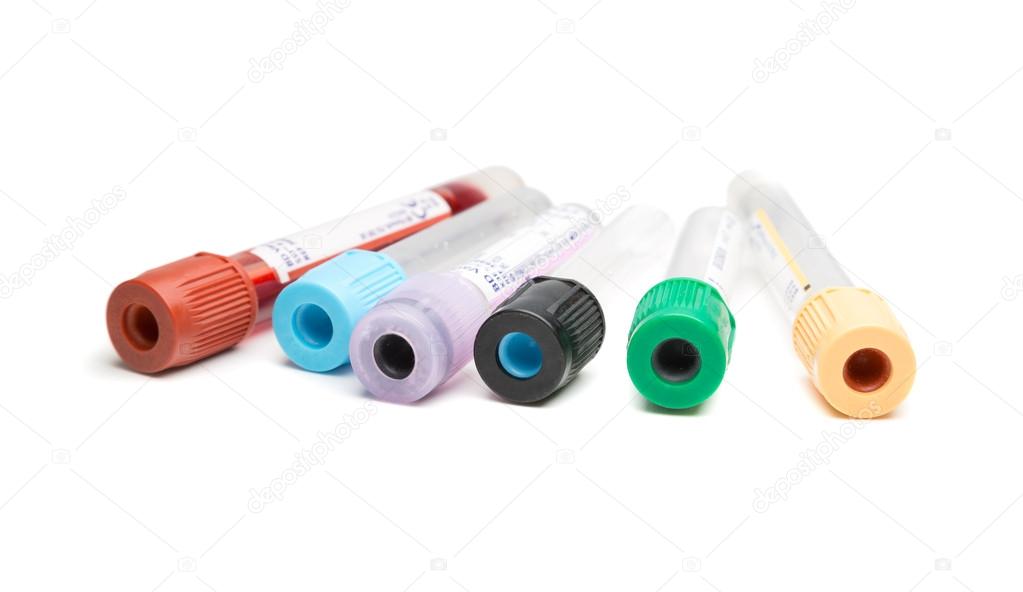 Test tubes — Stock Photo © rfphoto #42356251
