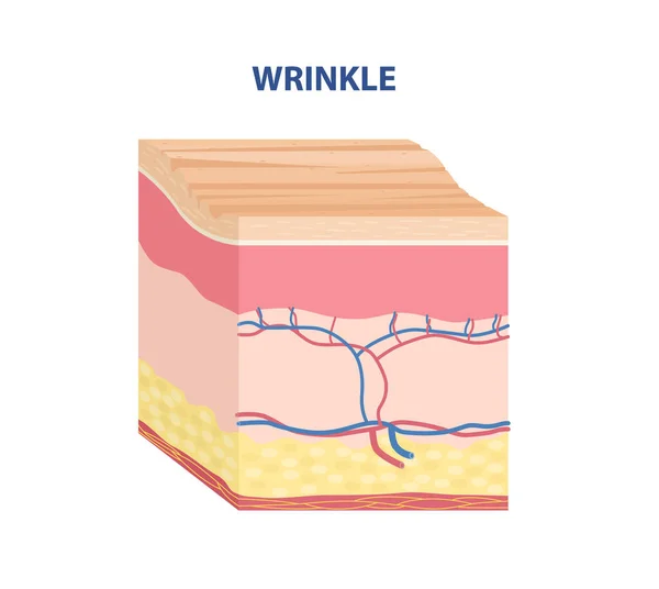 Layers of skin sticker Stock Vector by ©mentalmind 529735882