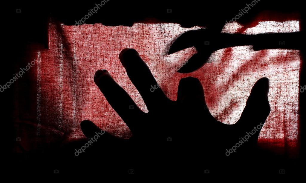 Mutilated Finger Stock Photo by ©DesignPicsInc 31798629