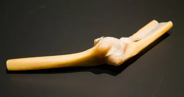 Prosthetic bone Stock Photos, Royalty Free Prosthetic bone Images ...