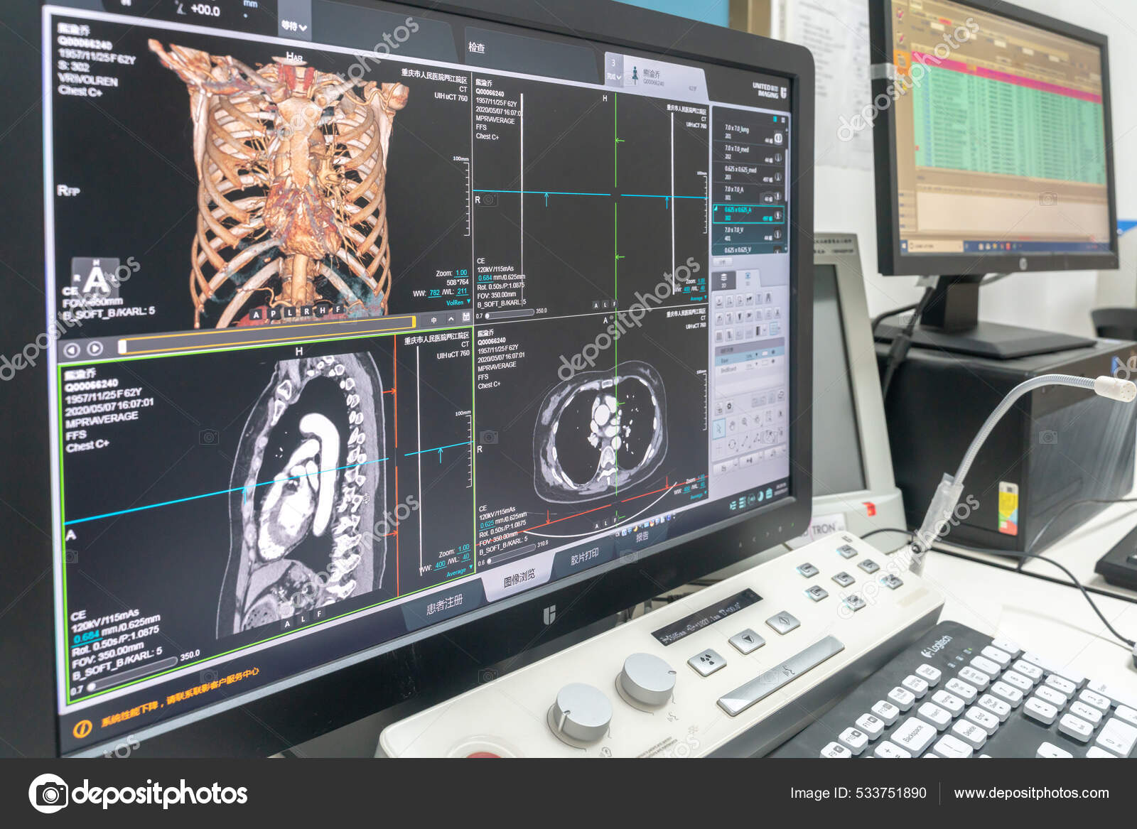Médecin Analyse Les Résultats L'irm Scanner Sur L'ordinateur Pendant Pandémie — Photo éditoriale ...