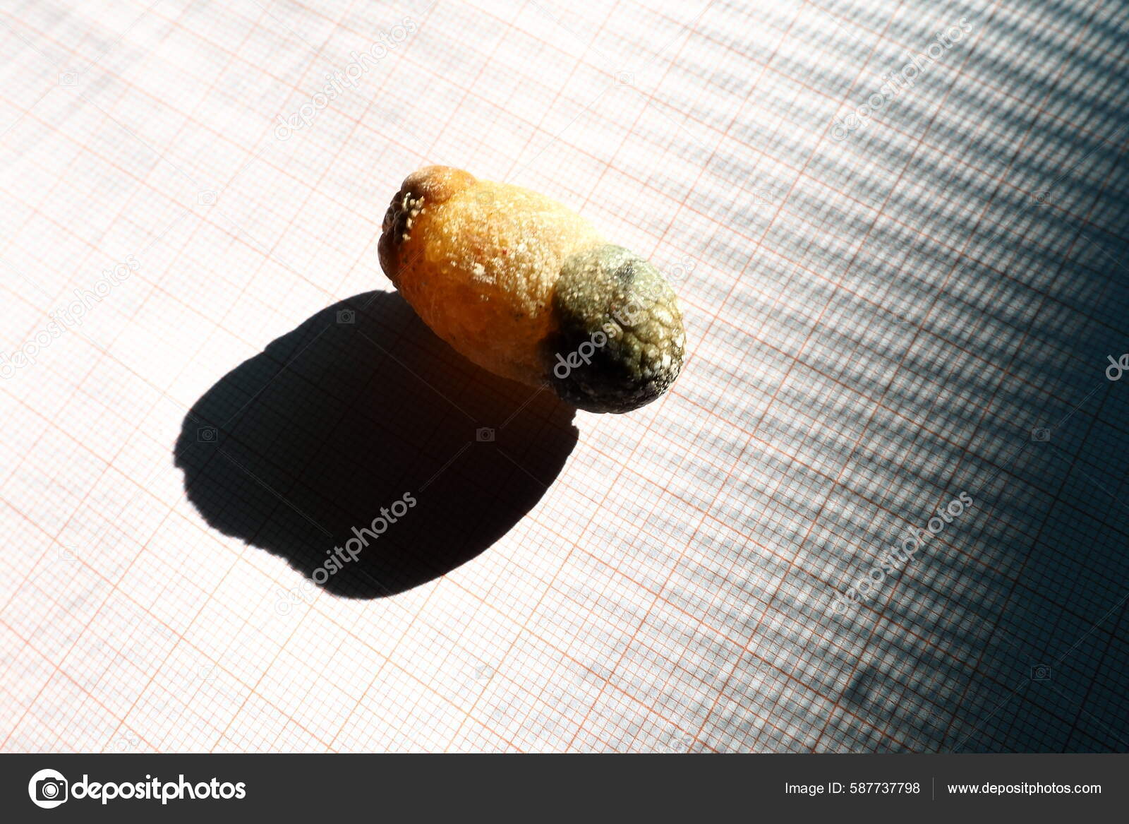 Gallstone Disease Cholelithiasis Formation Stones Stones Gallbladder ...