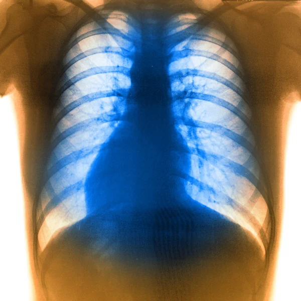 X-Ray scan human Stock Photo by ©wittybear 52417599