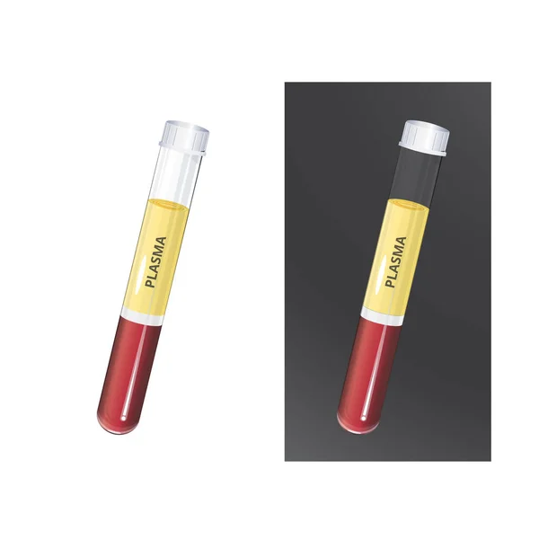 Platelet Rich Plasma Prp Glass Collection Tube Plasma Therapy ...
