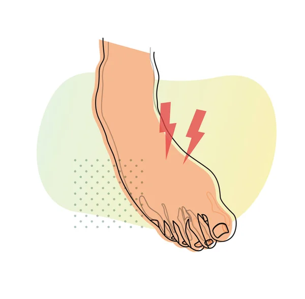 15,830,078 Necrotizing fasciitis Vector Images | Depositphotos