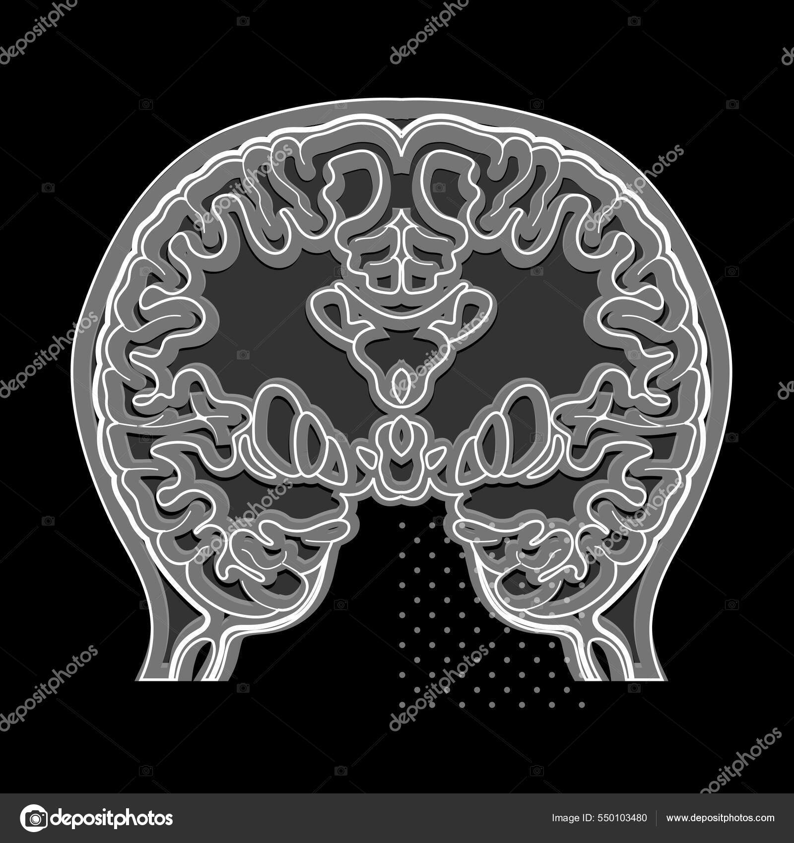 Transverse Section Of Brain