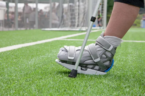 Broken foot Stock Photo by ©Jeanette.Dietl 36022023