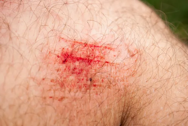 Scratches Stock Photos, Royalty Free Scratches Images | Depositphotos