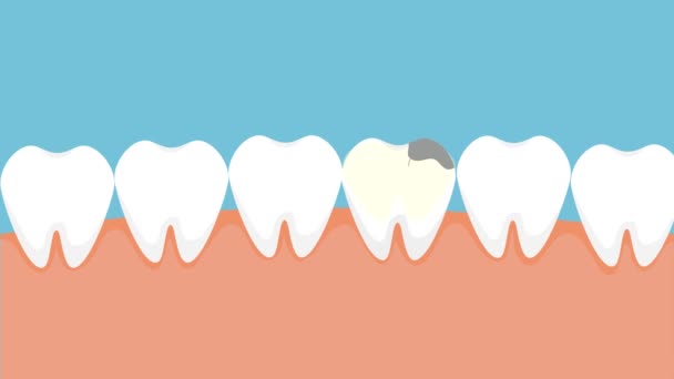 Reinserting A Knocked Out Tooth Clipart