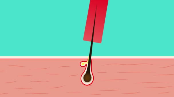 178 Hair growth animation Stock Videos, 4K & HD Footage | Depositphotos