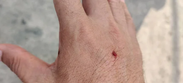 Afgebeten Stock Photos, Royalty Free Afgebeten Images | Depositphotos