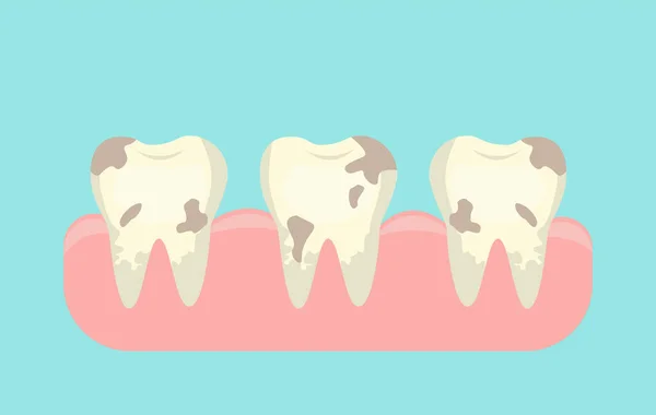 10,701,896 Tooth enamel illustration Vector Images | Depositphotos