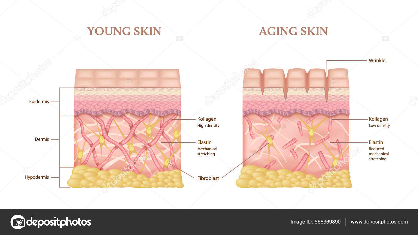 Skin Layers Infographics Stock Vector by ©macrovector 566369890