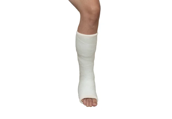 Ankle cast Stock Photos, Royalty Free Ankle cast Images | Depositphotos