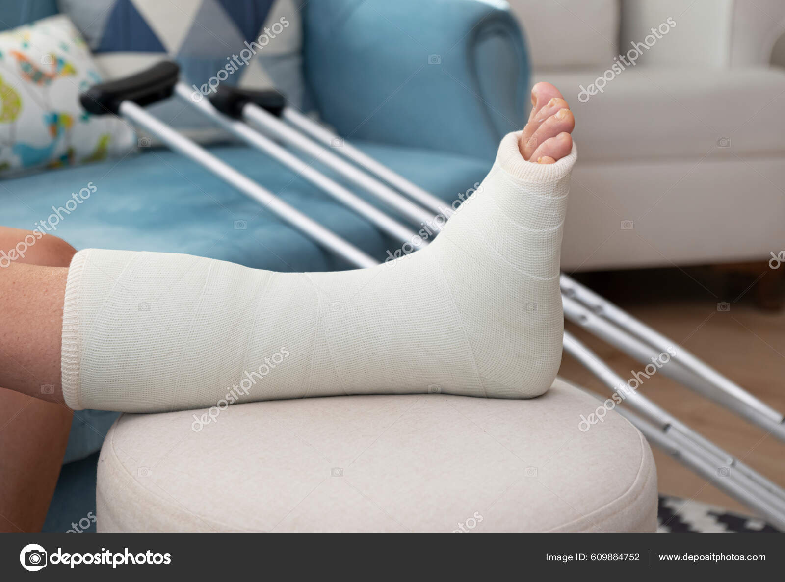Sprained Ankle Cast