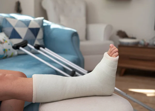 Broken Ankle Leg Cast Leg Splint — Stock Photo © bermek #609883934
