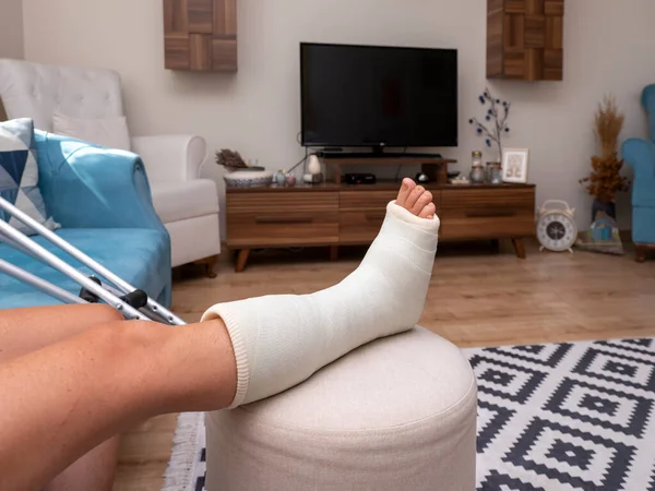 Broken Ankle Leg Cast Leg Splint — Stock Photo © bermek #609883934