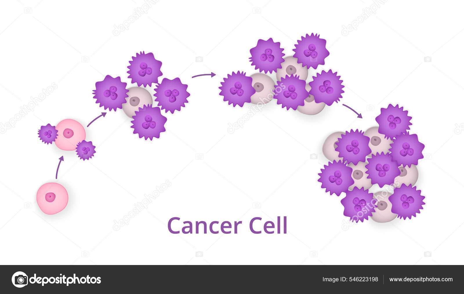Process of development of cancer cells Stock Vector Image by ...