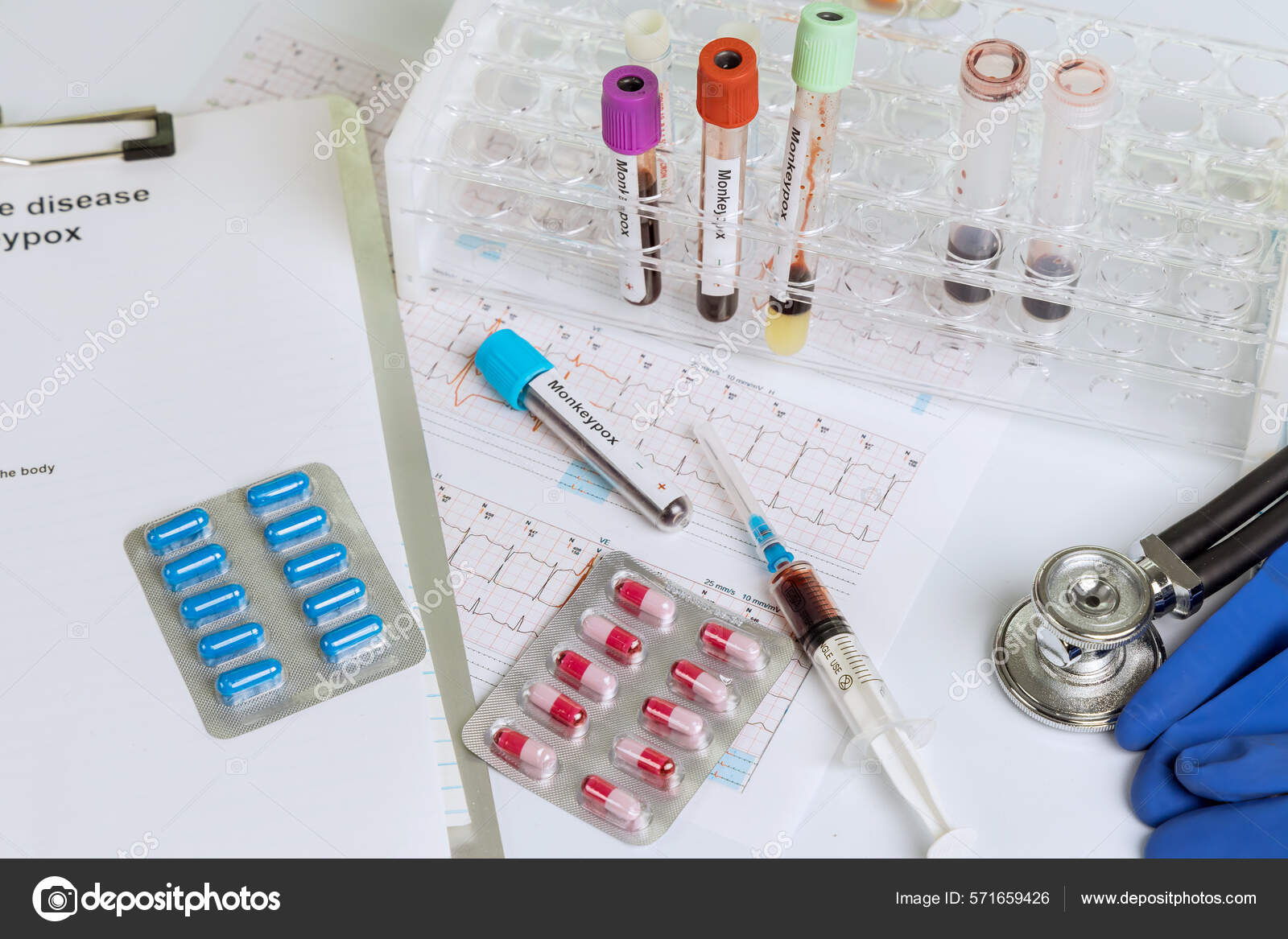 Blood sample with Monkeypox virus check-up analysis in laboratory with ...