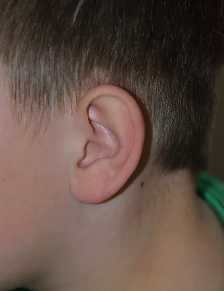 Pierced ear Stock Photo by ©MarcoGovel 23149620