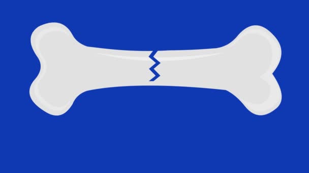 32 Breaking skeleton Videos, Royalty-free Stock Breaking skeleton ...