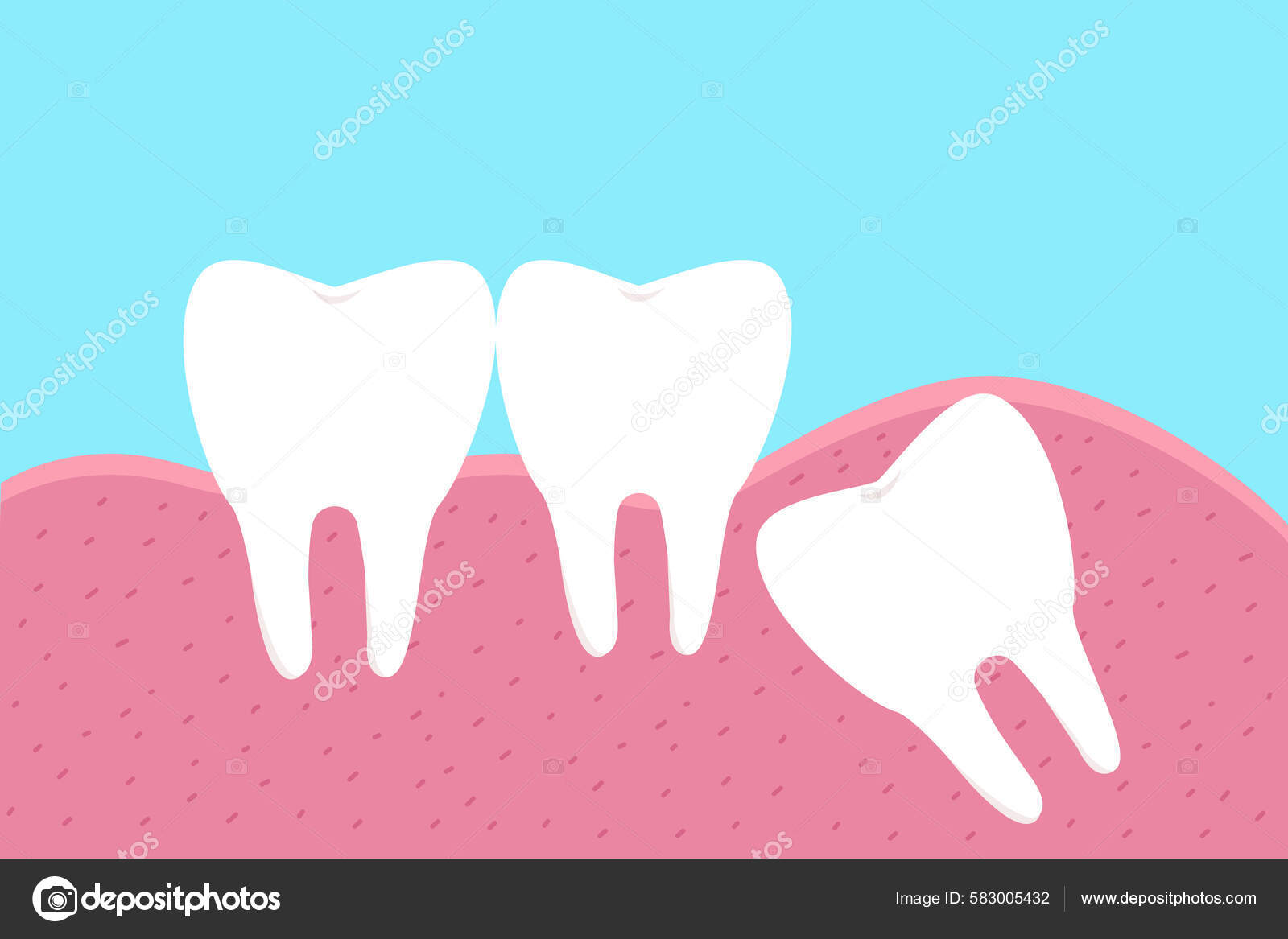 Illustration Wisdom Tooth Dental Concept Stock Vector Image by ...