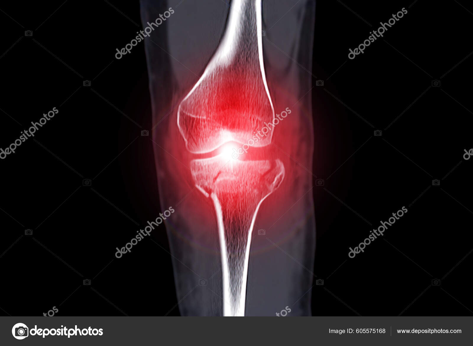 Scan Knee Joint Axial Coronal Sagittal View Stock Photo by ©samunella ...