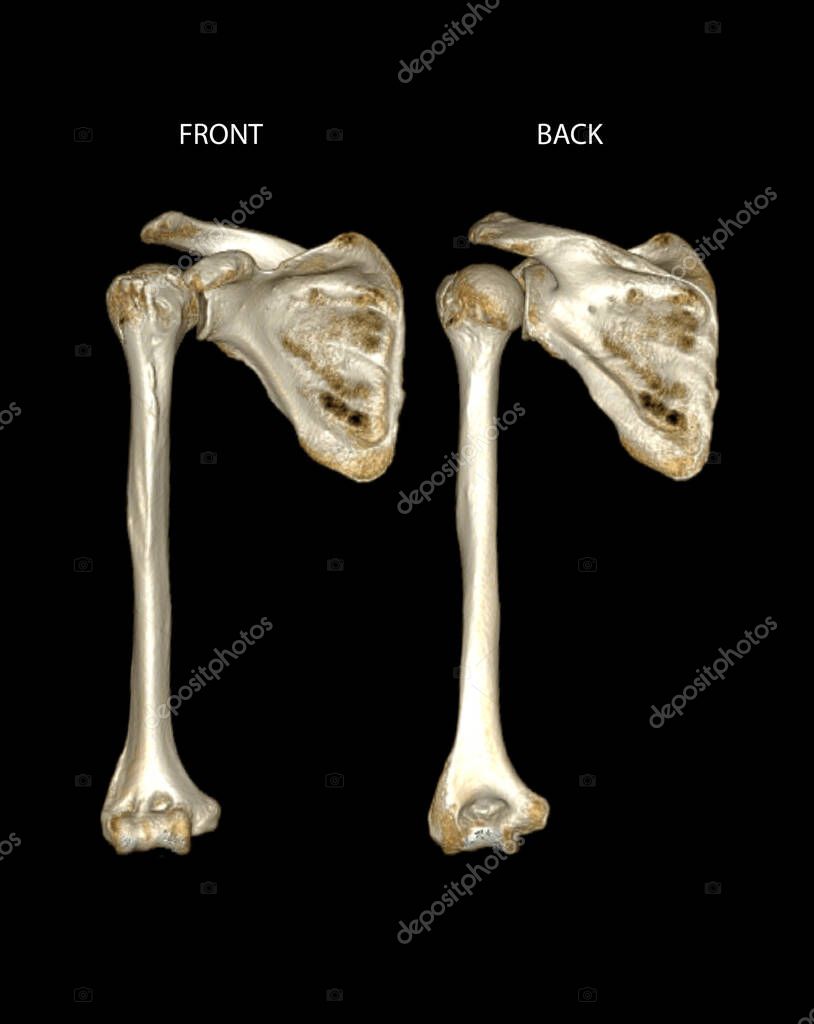 Computed Tomography Volume Rendering examination of the shoulder joint ... Computed Tomography Volume Rendering examination of the shoulder joint ...