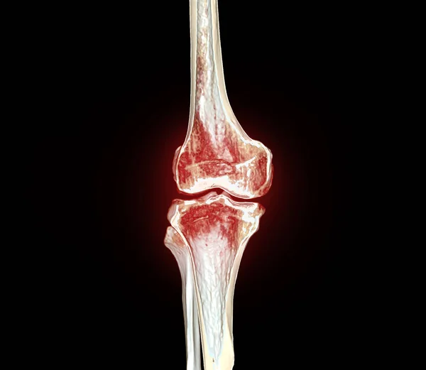 Sacroiliac Nivelen Lonkkanivelen Kuvaus Renderöinti Sacroiliac Nivelen ...