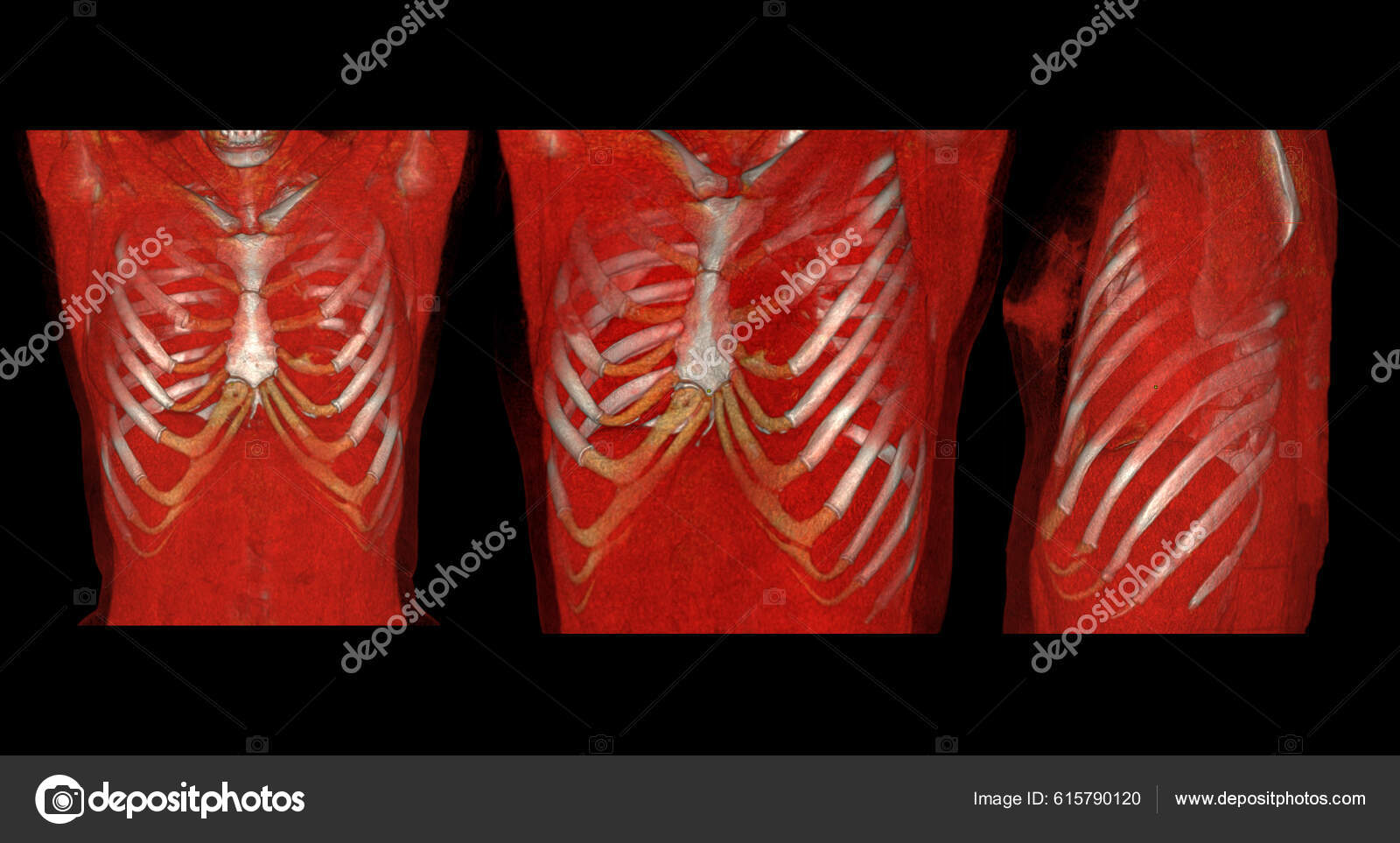 Chest Rendering Showing Rib Cage Skeleton Human Bones System Realistic ...