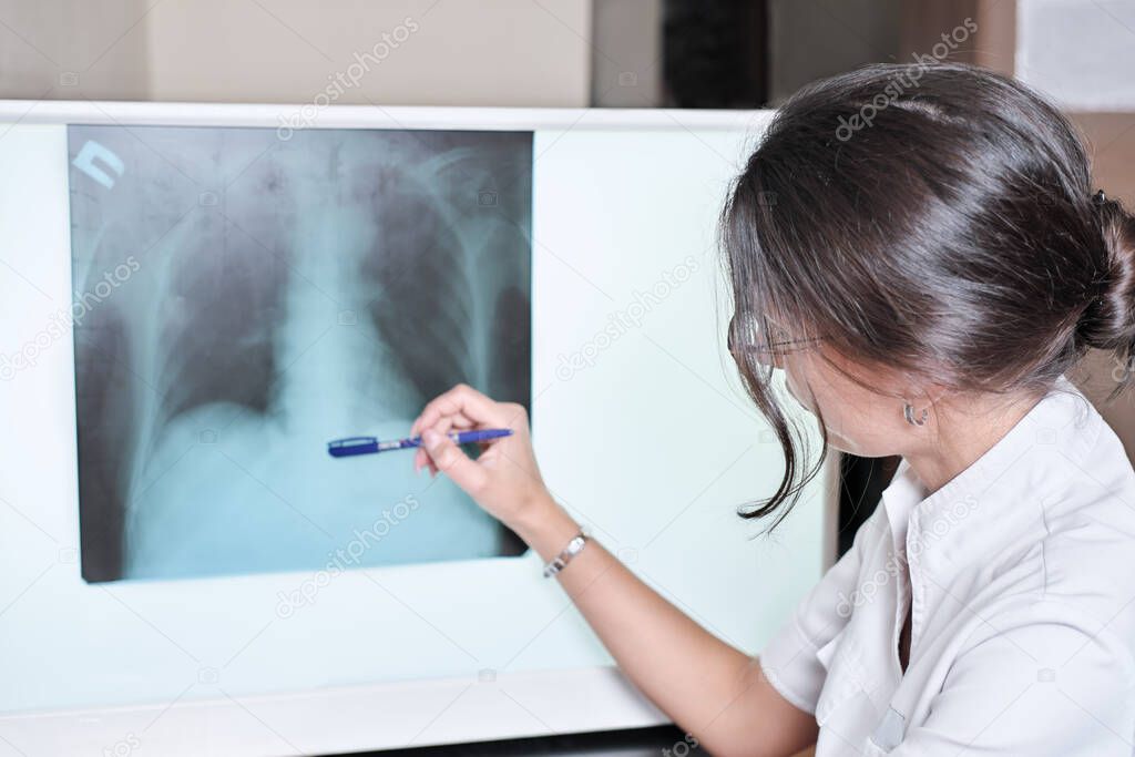 médico revisando la radiografía de tórax del pecho. joven radióloga ...